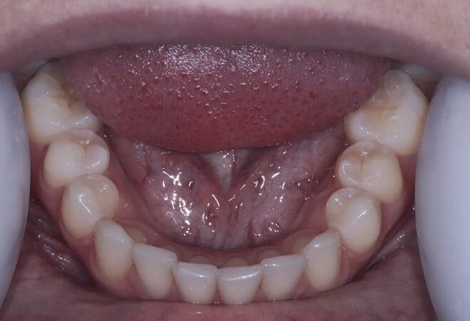 Virtual Consult - Kinetic Braces