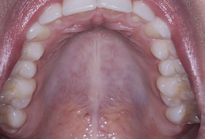 Virtual Consult - Kinetic Braces